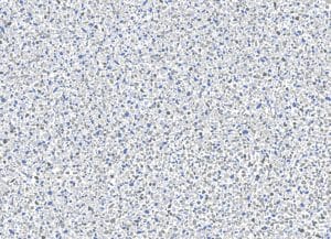 Crystal Quartz - Latham Pool